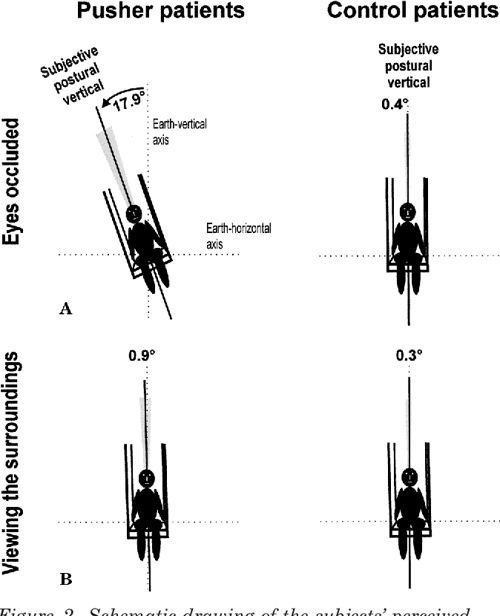 Figure 2 from The origin of contraversive pushing | Semantic Scholar