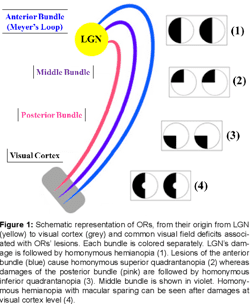 Figure 1 from MRI Investigation of Optic Radiations in Human Brain: New ...