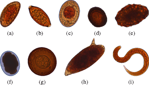 Figure 2 from Automated diagnosis of human intestinal parasites using ...