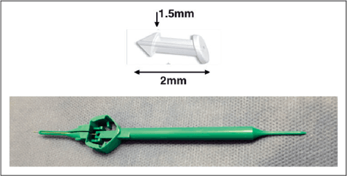 Figure 3 from Three-snip punctoplasty versus perforated plugs for ...