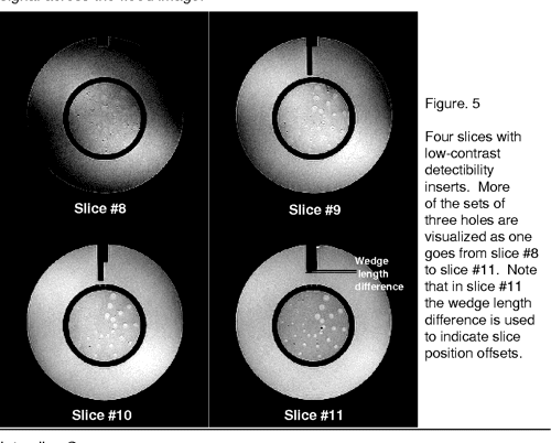 Figure 1 from OVERVIEW OF THE ACR MRI ACCREDITATION PHANTOM | Semantic ...