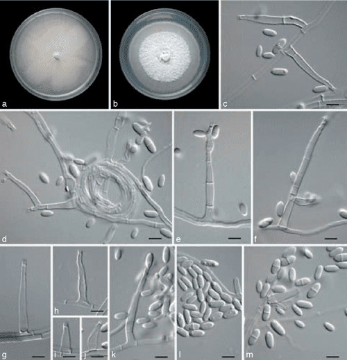 Figure 8 from Plectosphaerella species associated with root and collar ...