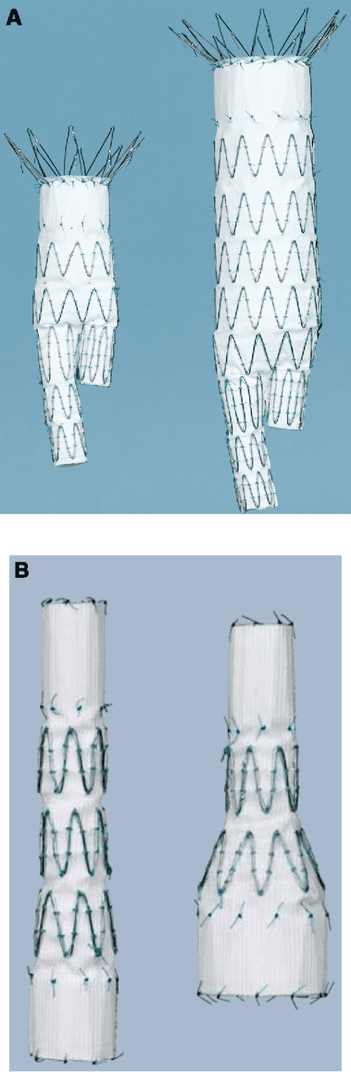 Figure 3 from The Cook Zenith AAA endovascular graft. | Semantic Scholar