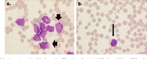 Table 1 from Presence of Gumprecht shadows (smudge cells) in bovine ...