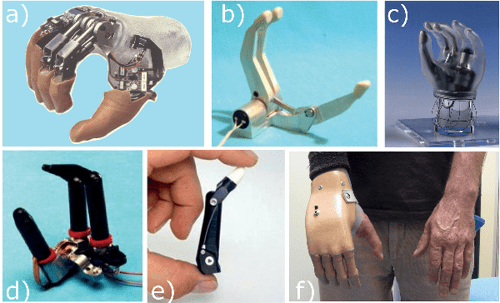 Treatment of the Partial Hand Amputation: An Engineering Perspective ...