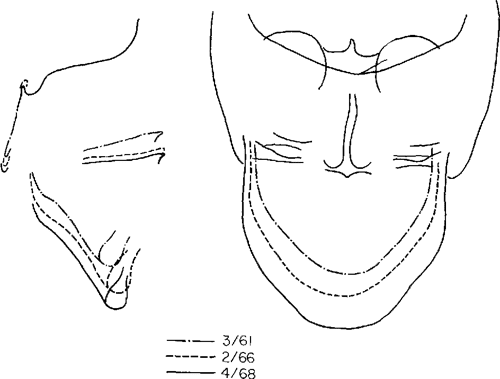 The primary role of functional matrices in facial growth. | Semantic ...