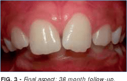 Figure 1 from Zinc oxide-eugenol paste retained in gingival mucosa ...