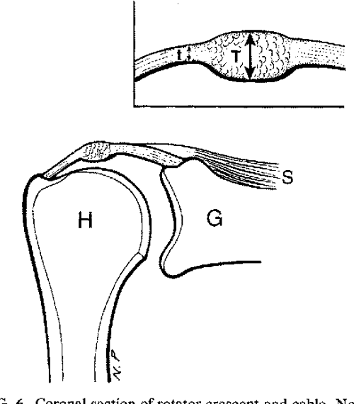 The rotator crescent and rotator cable: an anatomic description of the ...