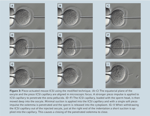 Figure 1 from Intracytoplasmic Sperm Injection ( ICSI ) in the Mouse ...