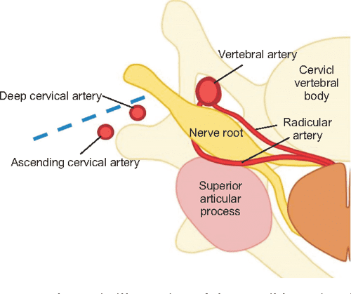 Figure 2 from Ultrasonography Evaluation of Vulnerable Vessels Around ...