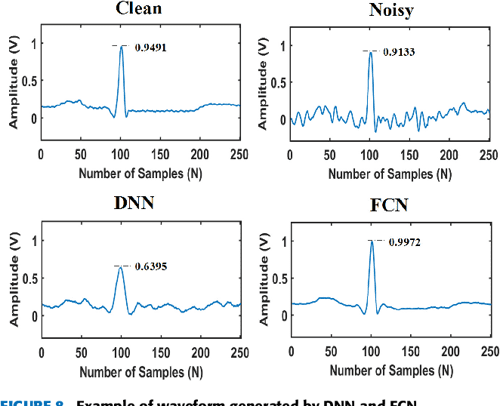 [pdf] Noise Reduction In Ecg Signals Using Fully Convolutional Denoising Autoencoders Semantic