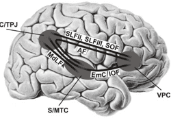 Figure 1 from The anatomy of spatial neglect | Semantic Scholar