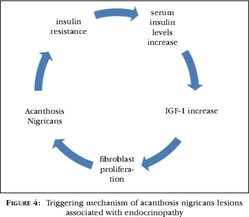 Figure 1 from Association of acanthosis nigricans and skin tags with ...