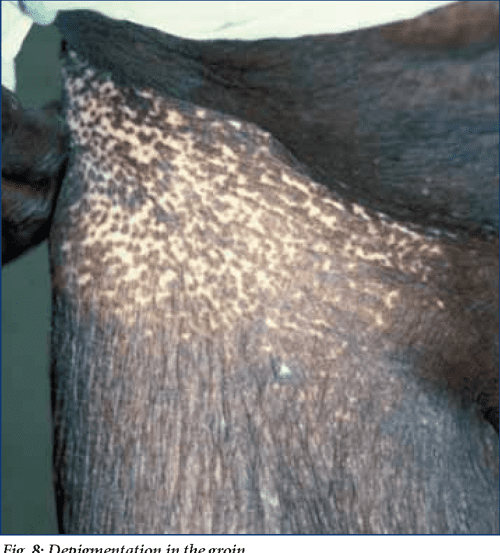 Figure 2 from ONCHOCERCIASIS AND THE AFRICAN PROGRAMME FOR ...