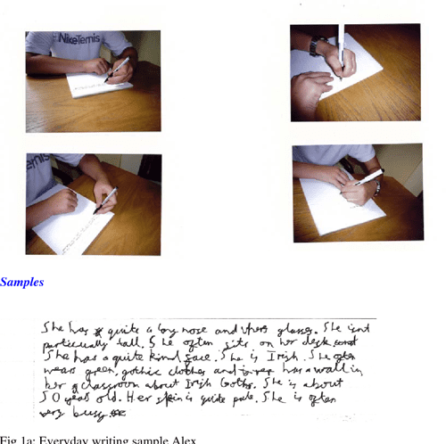 [PDF] Assessment of Speed of Handwriting ( DASH ) : What the DASH can ...