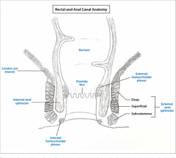 Perianal Fistulas in Patients With Crohn's Disease, Part 1: Current ...