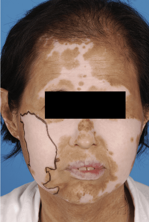 Figure 16 from Presentations, Signs of Activity, and Differential ...