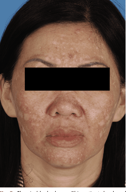 Figure 16 from Presentations, Signs of Activity, and Differential ...