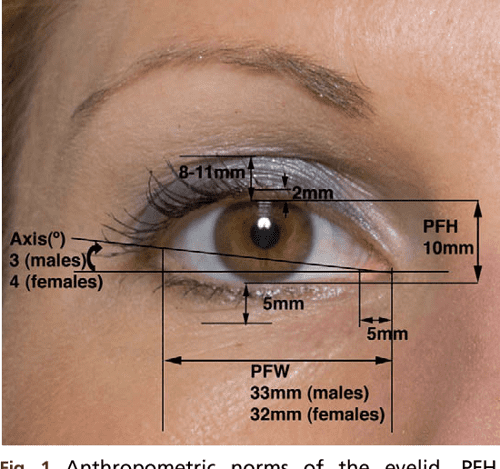 Figure 1 from Aesthetic eyelid reconstruction. | Semantic Scholar