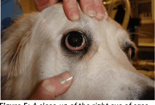 Figure 4 from Extraocular polymyositis | Semantic Scholar