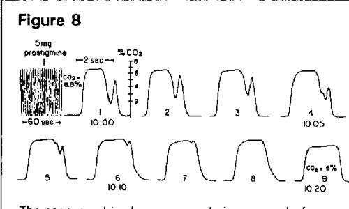 Figure 10 from End-tidal CO2 monitoring during anesthesia. | Semantic ...