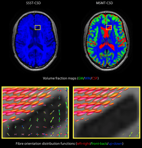 Figure 5 From Multi Tissue Constrained Spherical Deconvolution For Improved Analysis Of Multi