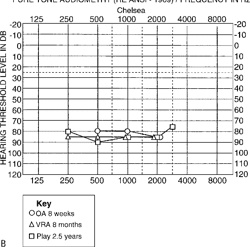 Table 6–1 from Chapter 6 Using Behavioral Observation Audiometry to ...