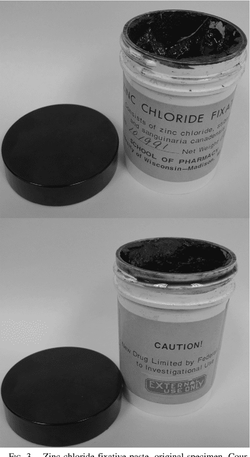 Figure 4 from Frederic E. Mohs, M.D. (1910—2002): Physician and ...