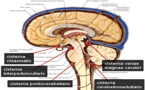 Figure 1 from ANATOMY OF THE LAMINA TERMINALIS AND THE CISTERNA ...
