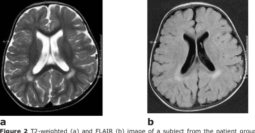 Figure 1 from Differentiation between peritrigonal terminal zones and ...