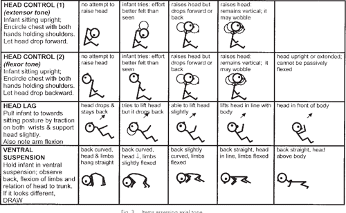 Figure 8 from The Dubowitz neurological examination of the full-term ...