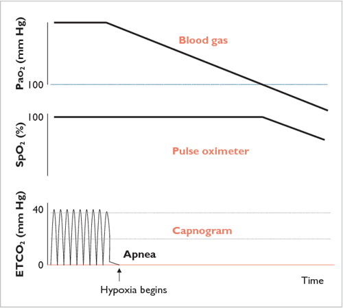 Table 1 from Capnography in Dogs | Semantic Scholar