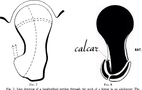 Figure 2 from The calcar femorale and the femoral neck. | Semantic Scholar