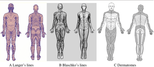 Figure 1 from Skin diseases following a Christmas tree pattern ...