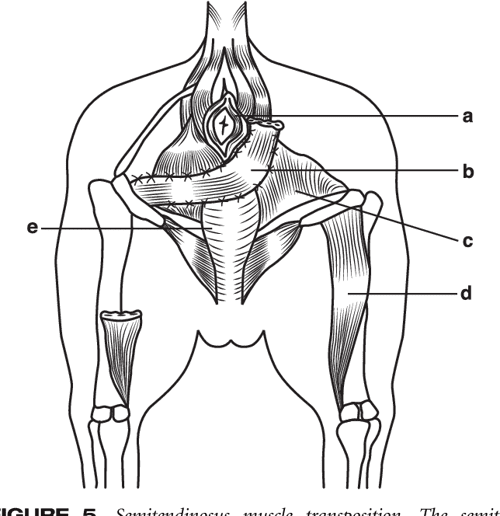 Figure 2 from A Review of the Surgical Management of Perineal Hernias ...
