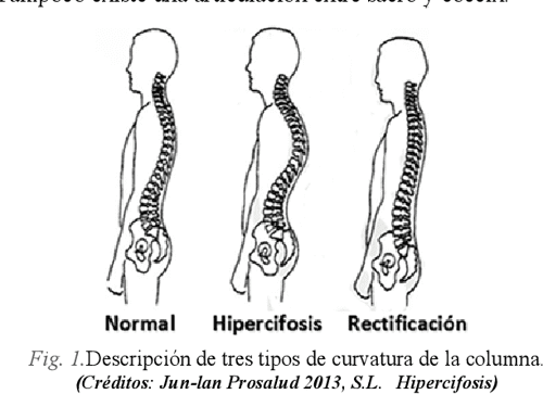 Figure 1 from Método Computacional para Cálculo de Lordosis Lumbar y ...