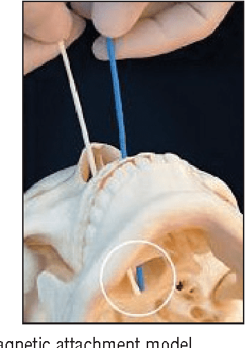 Figure 3 from Nasal Bridle : Married to Your Tube CASE SCENARIOS ...