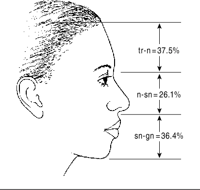 Table 1 from Anthropometric facial analysis of the African American ...
