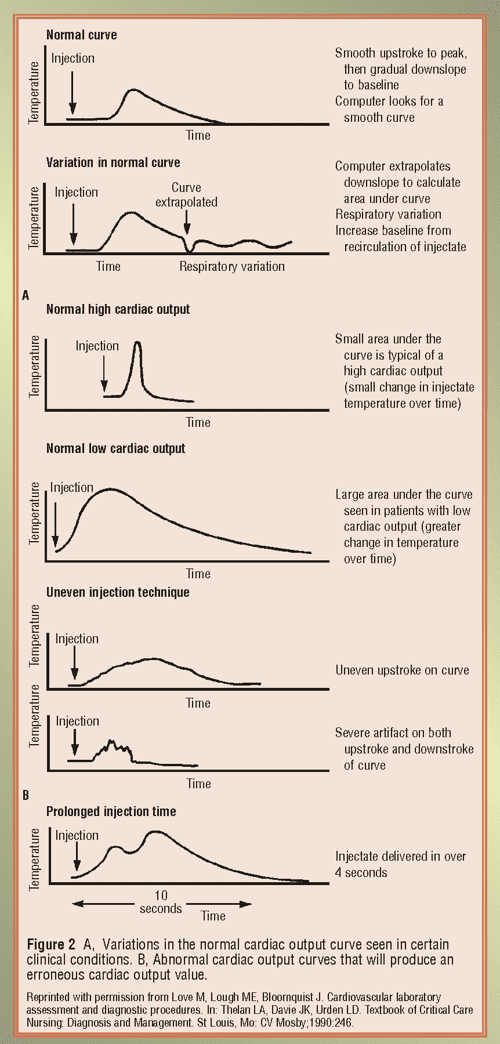 [PDF] Measuring cardiac output: intermittent bolus thermodilution ...