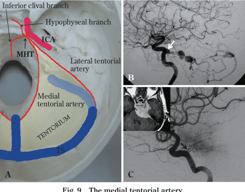 Figure 8 from Microsurgical Anatomy and Surgical Procedures for the ...