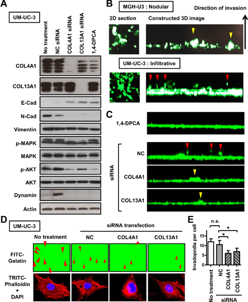 Figure 3 from Collagen type IV alpha 1 (COL4A1) and collagen type XIII ...