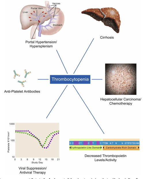 Thrombocytopenia associated with chronic liver disease. | Semantic Scholar
