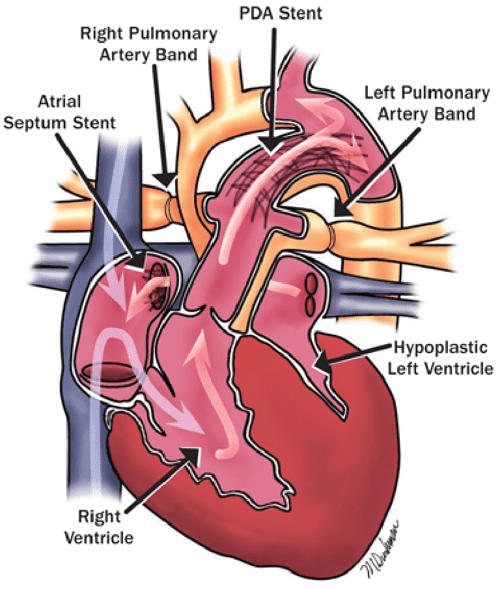 Figure 2 from A Coupled CFD-Lumped Parameter Model of the Human ...