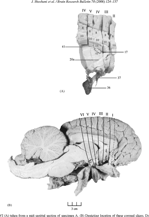 Figure 11 from Elephant brain Part I: Gross morphology, functions ...