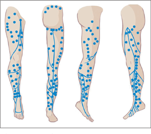 table-1-from-the-venous-perforators-of-the-lower-limb-a-new