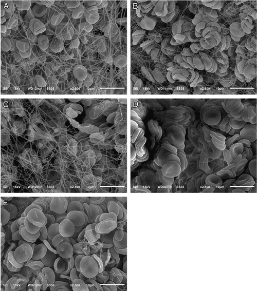 Figure 2 from The Effects of EDTA on Blood Clot in Regenerative ...