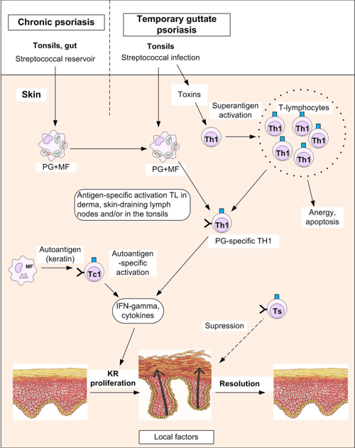Figure 12 from Model of pathogenesis of psoriasis. Part 1. Systemic ...