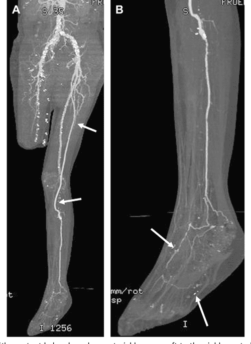Figure 26 from CT angiography of the lower extremities. | Semantic Scholar