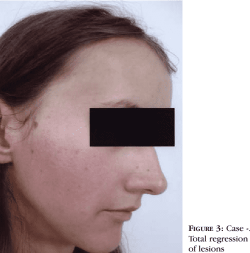 Figure 1 from Dermatosis neglecta: a report of two cases. | Semantic ...