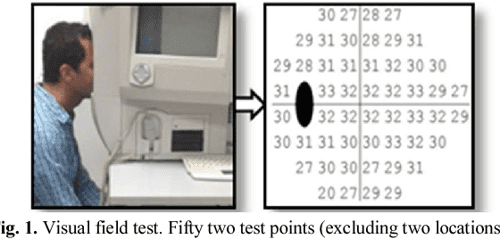 Glaucoma Monitoring Using Manifold Learning and Unsupervised Clustering | Semantic Scholar